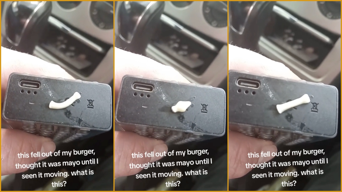 ‘A Half Tapeworm, a Trip to the ER, and a Million Dollar Paycheck’: Man ...