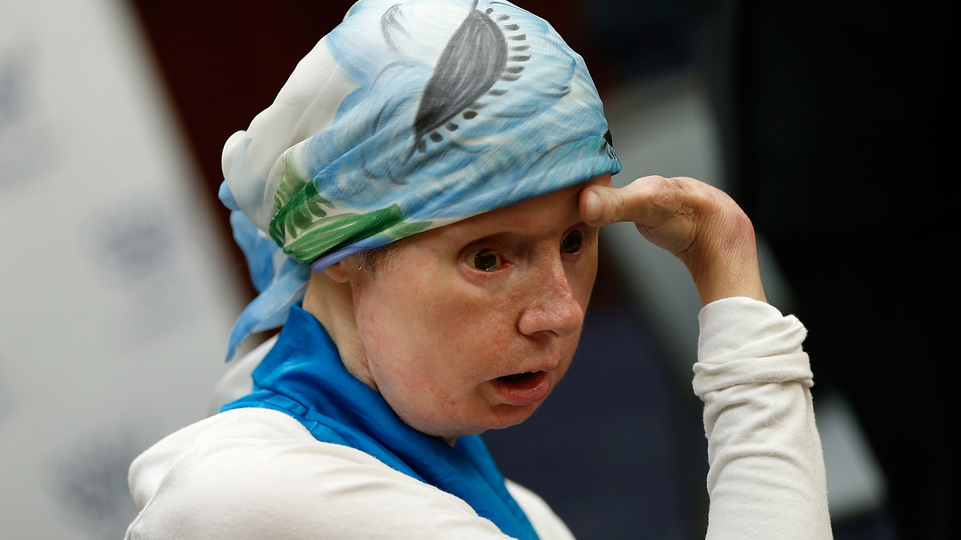 What Is the Story of Travis the Chimp, and What Happened to Charla Nash?