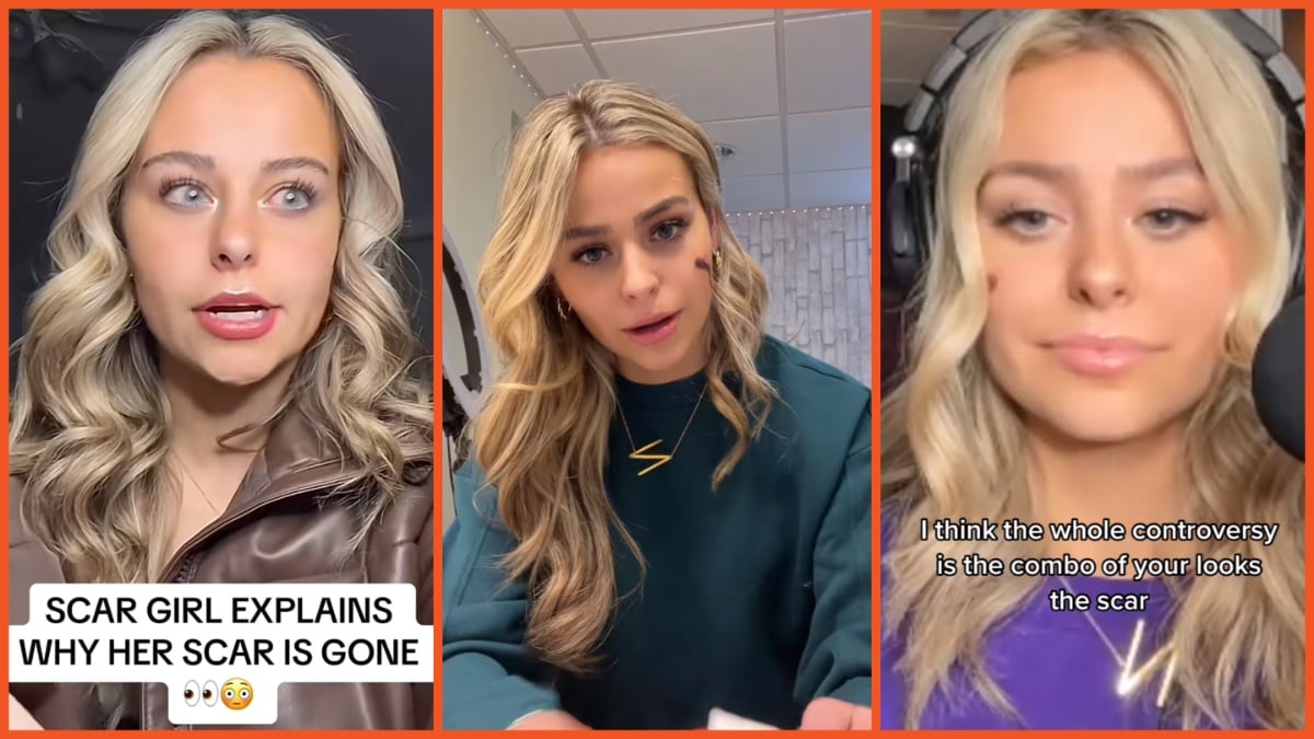 Who Is TikTok’s Scar Girl and Why Do Users Think She’s a Fake?